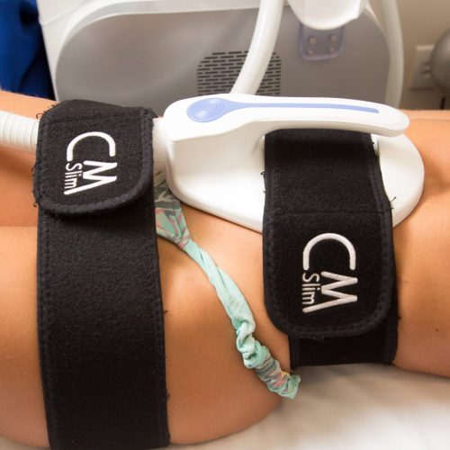 Conheça o CM Slim: eletroestimulador muscular para ajudar na ...